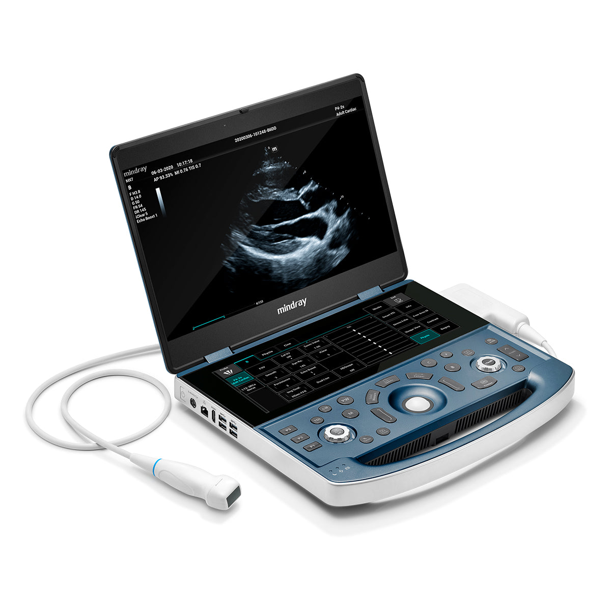 Ultrasonido Portátil MX7 / Ecógrafo Portátil MX7 Marca Mindray – HERGOM MEDICAL