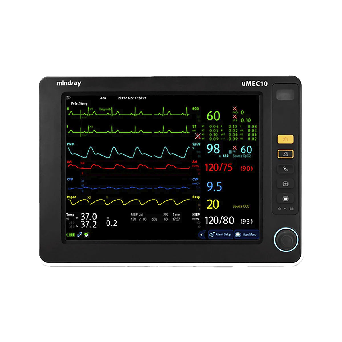 Monitores y oxímetros veterinarios Mindray Animal Care – HERGOM MEDICAL