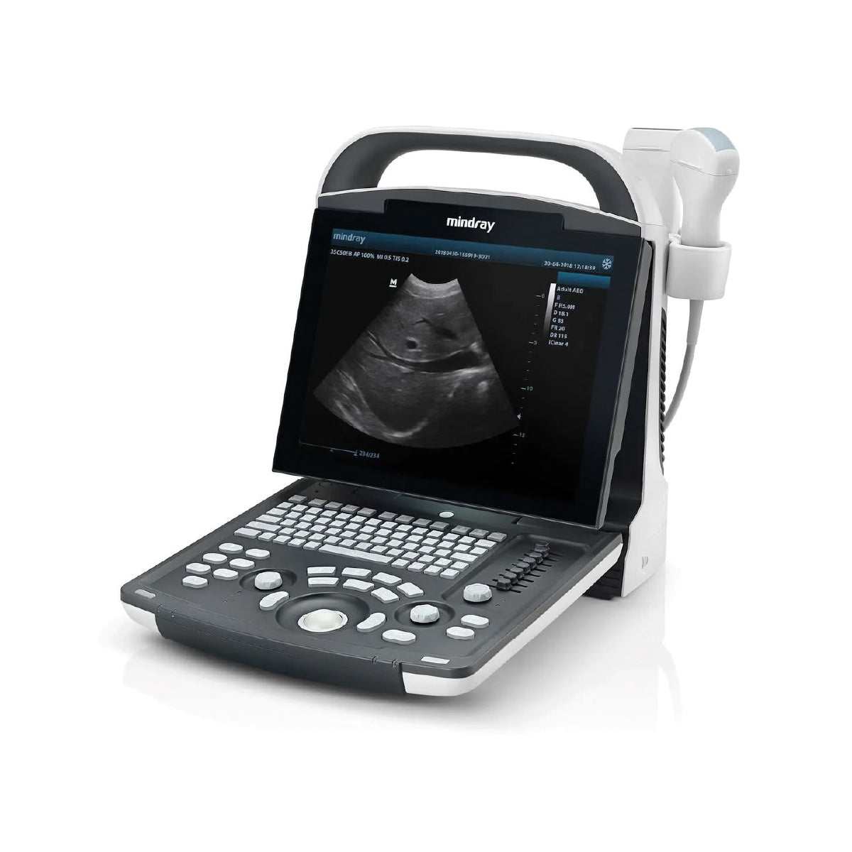 Ultrasonido Portátil para Uso Humano DP20 con Transductor Convexo y Li – HERGOM MEDICAL